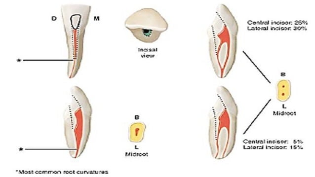 Morphology of mandibular incisors | PPT