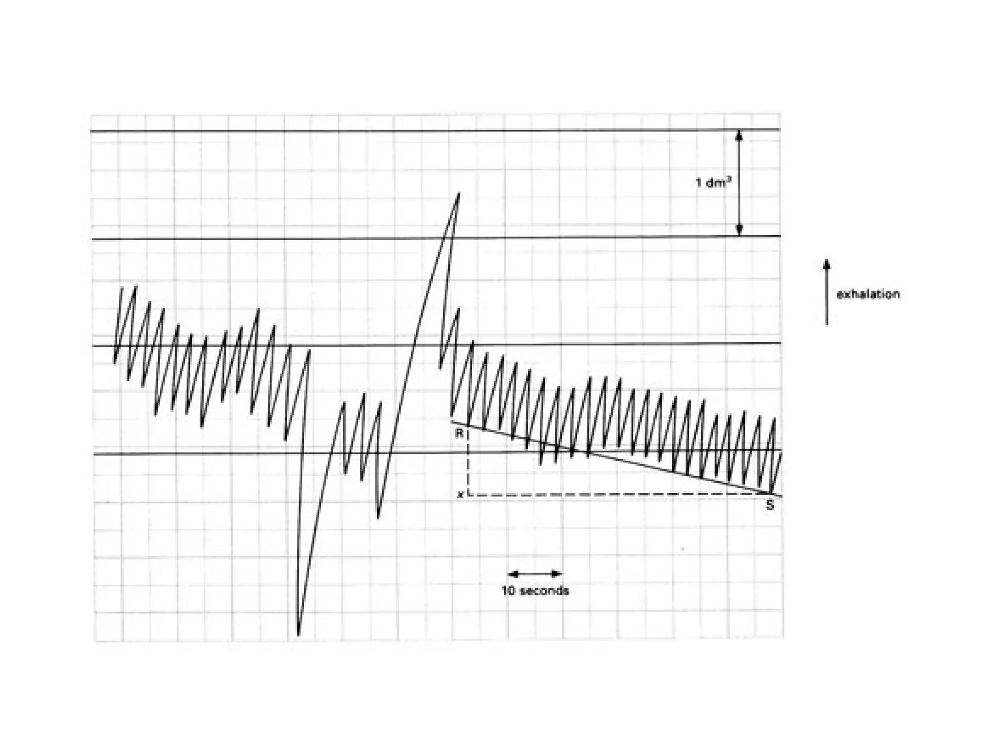 L4 spirometer | PPT