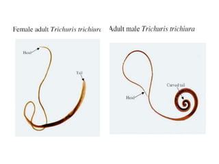 L4 T trichura.pptx