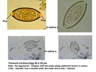 L4 T trichura.pptx