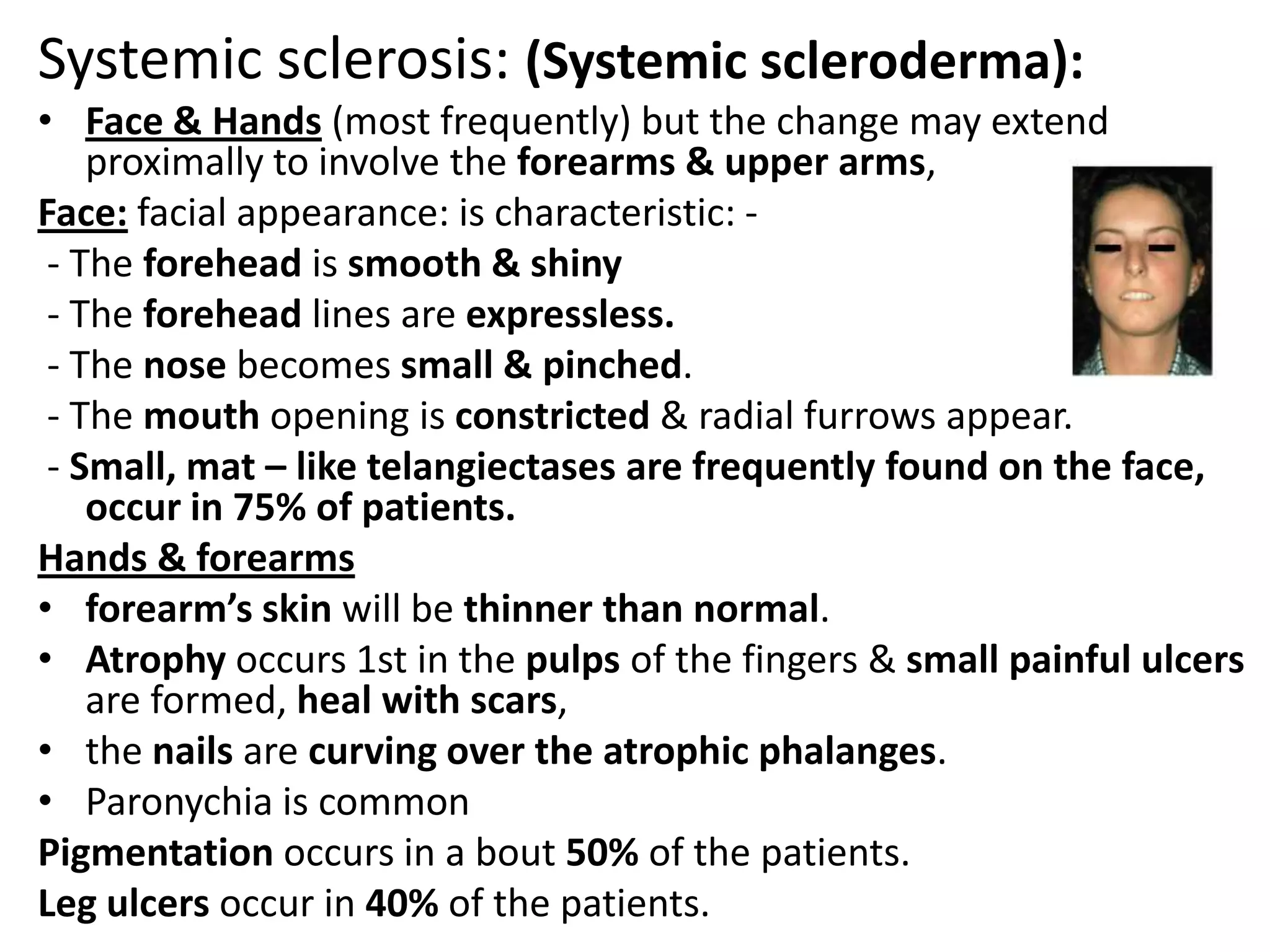 Dermatology 5th year, 5th lecture (Dr. Kazhan) | PPTX