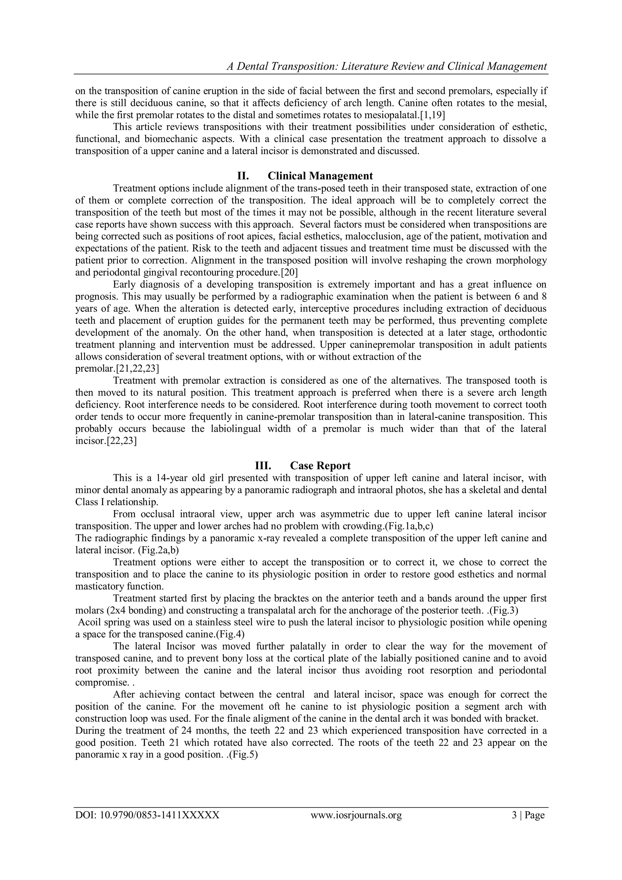 A Dental Transposition: Literature Review and Clinical Management | PDF
