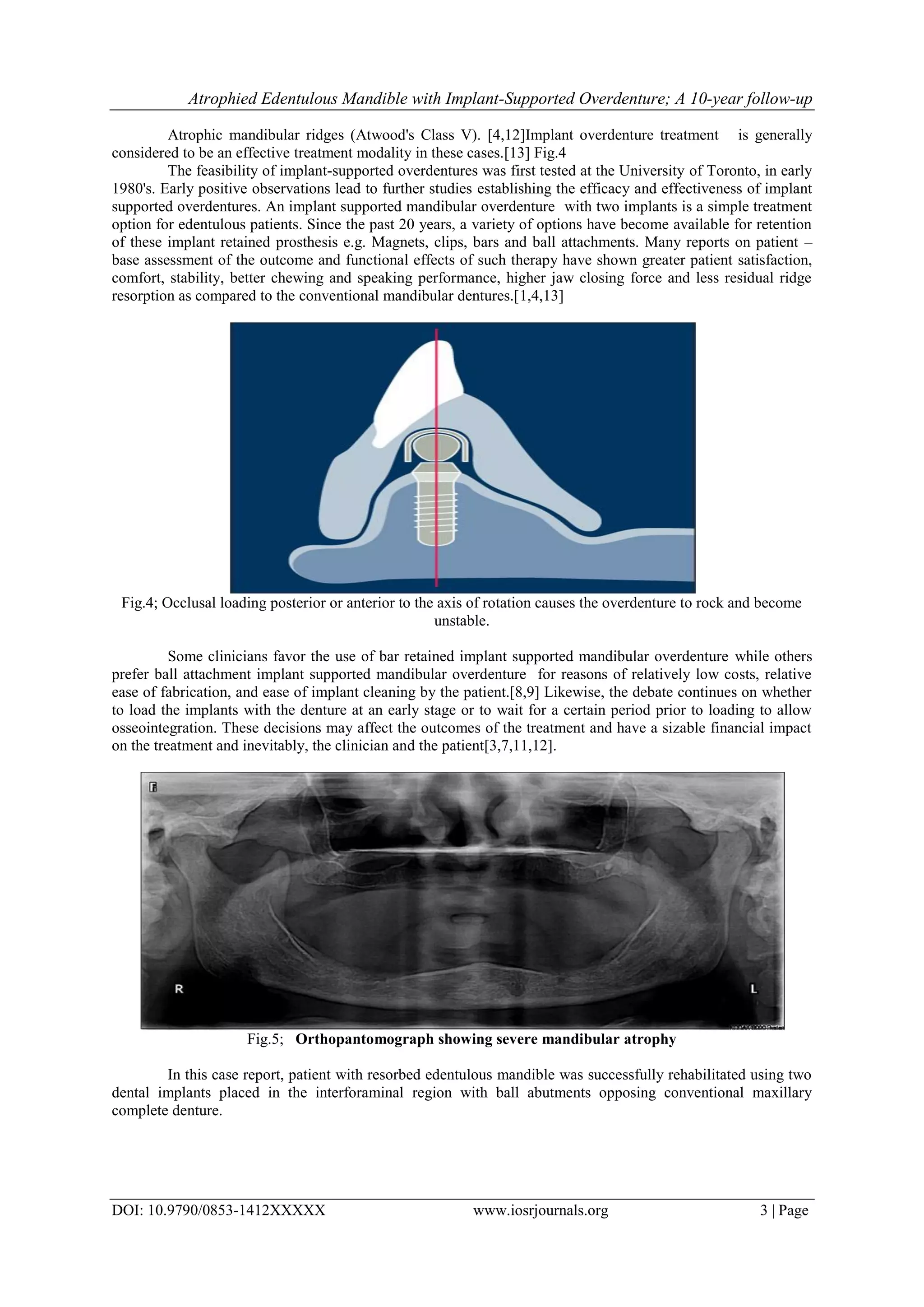 Atrophied Edentulous Mandible with Implant-Supported Overdenture; A 10 ...