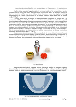 Atrophied Edentulous Mandible with Implant-Supported Overdenture; A 10 ...
