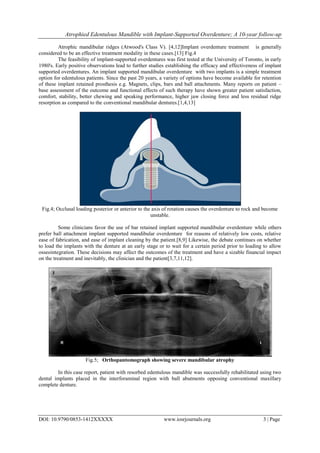 Atrophied Edentulous Mandible with Implant-Supported Overdenture; A 10 ...