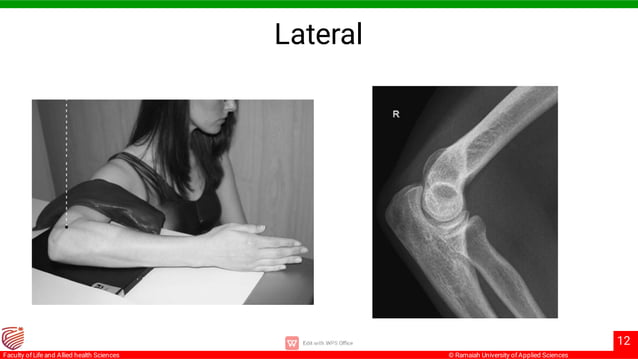Radiographic techniques of elbow (Elbow) | PDF