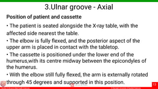 Radiographic techniques of elbow (Elbow) | PDF