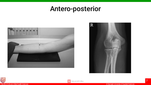 Radiographic techniques of elbow (Elbow) | PDF