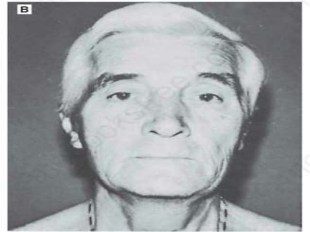 L6-8.Disorders of the reproductive system.pptx