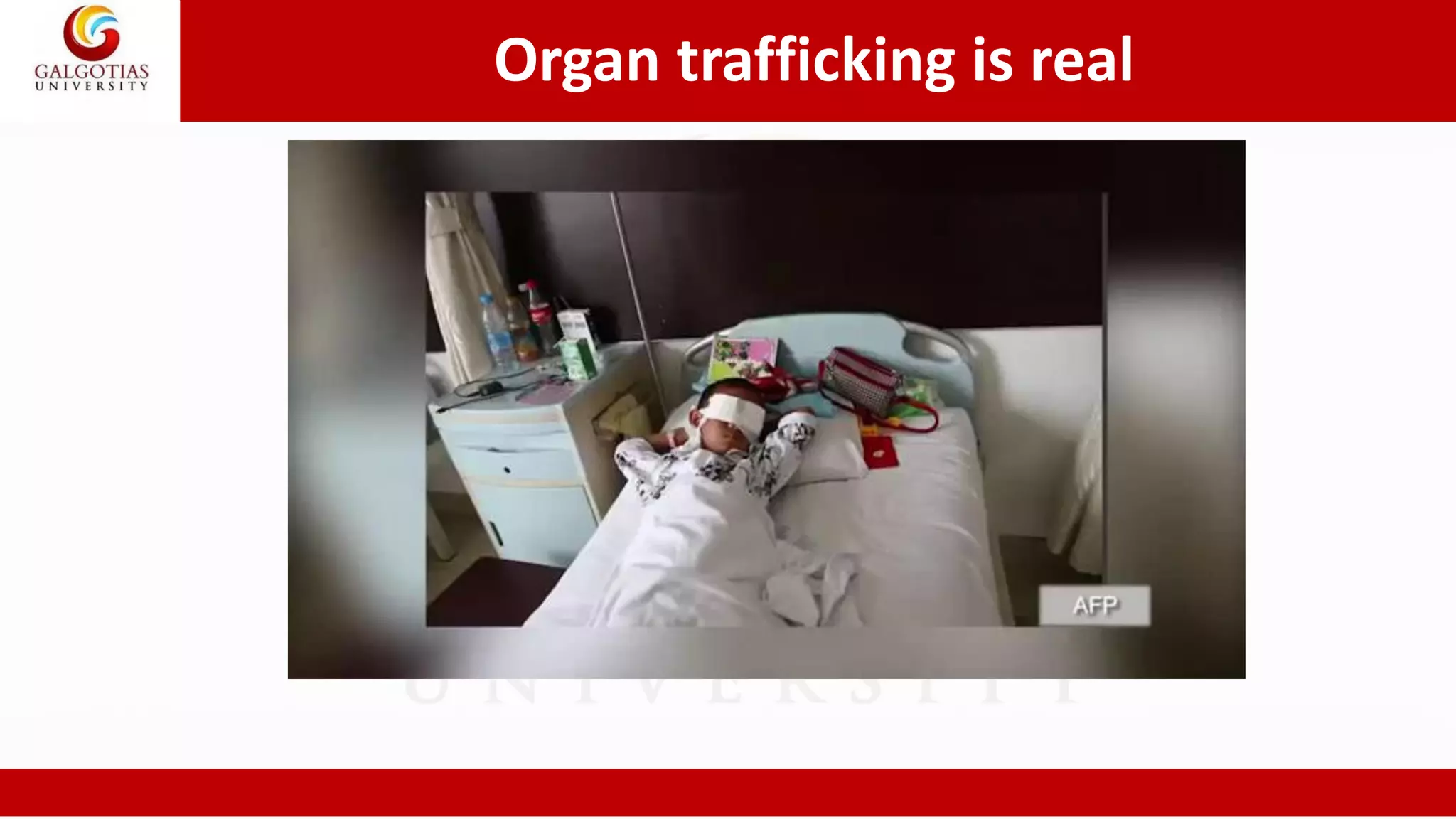 Ethics in organ transplantation | PDF