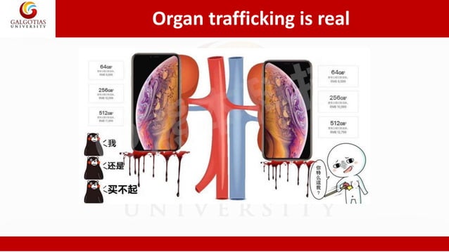 Ethics in organ transplantation | PDF