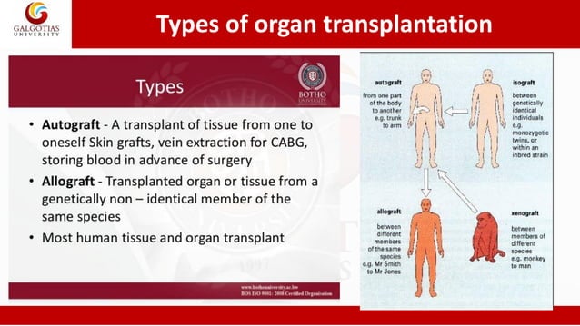 Ethics in organ transplantation | PDF