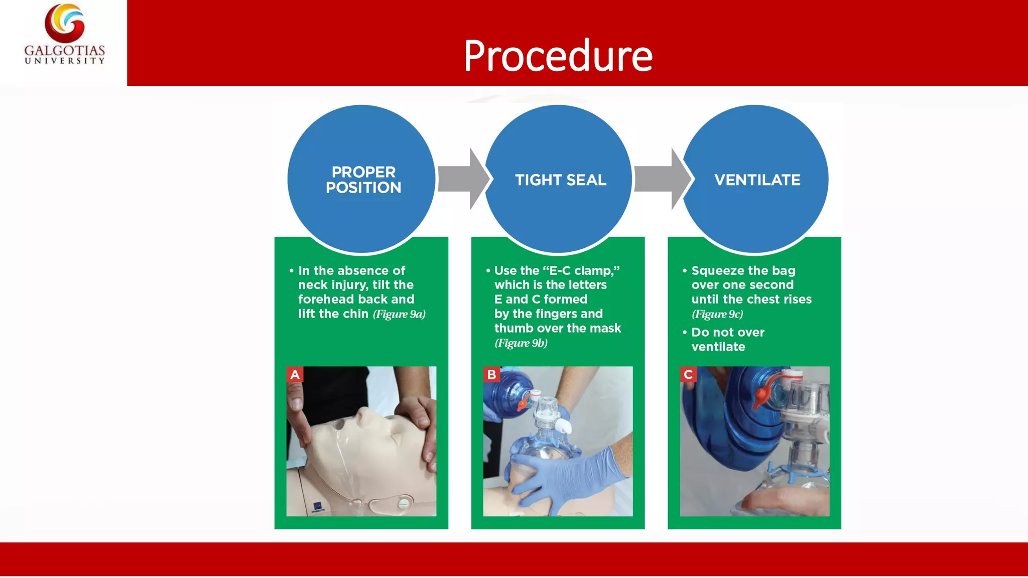 Chockinf and ventilation including Use of BVM | PDF