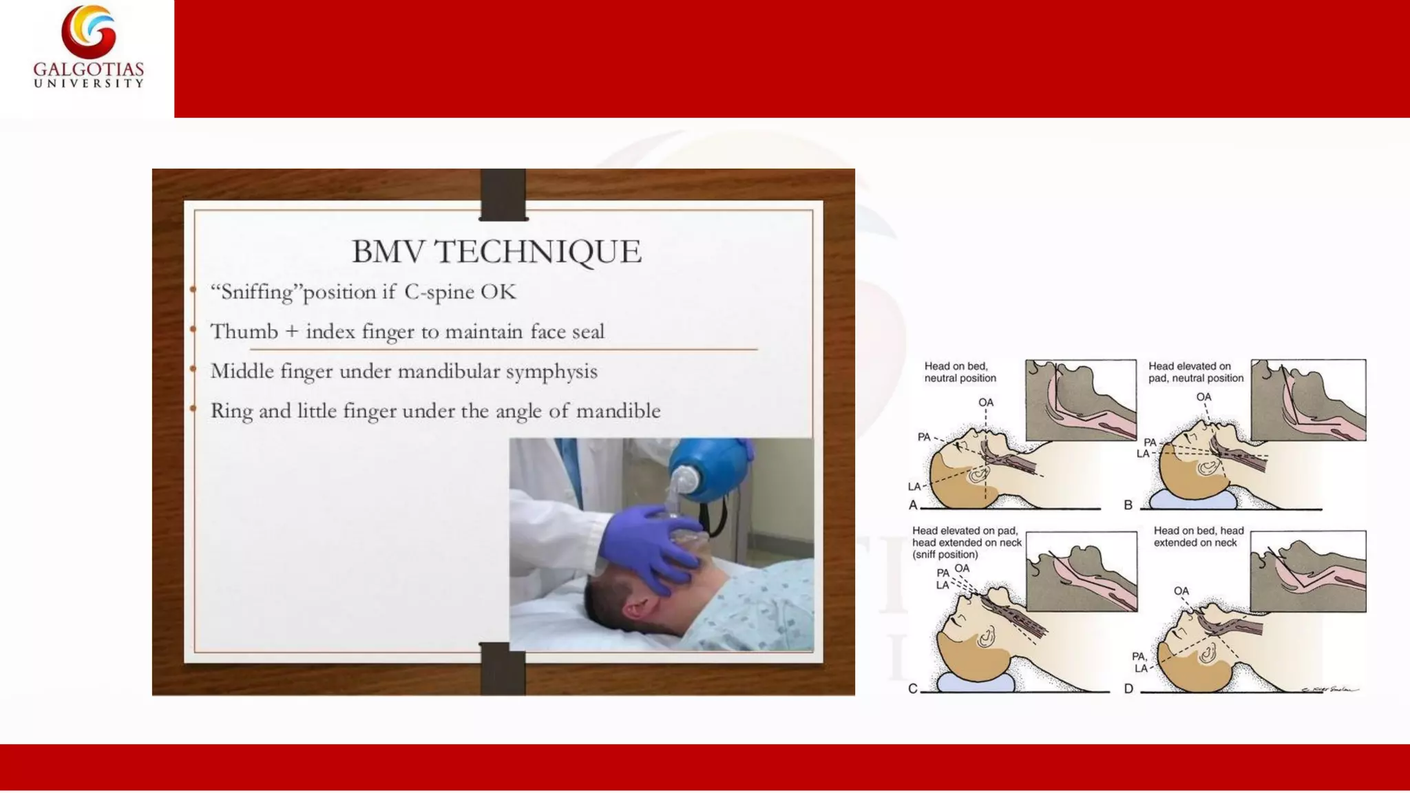 Chockinf and ventilation including Use of BVM | PDF