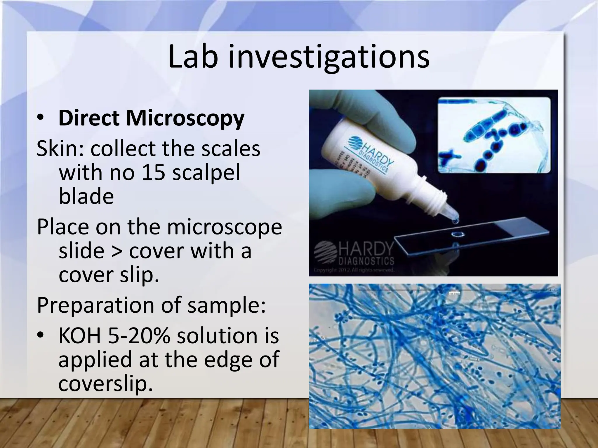 Common Fungal Infections of The Skin.ppt