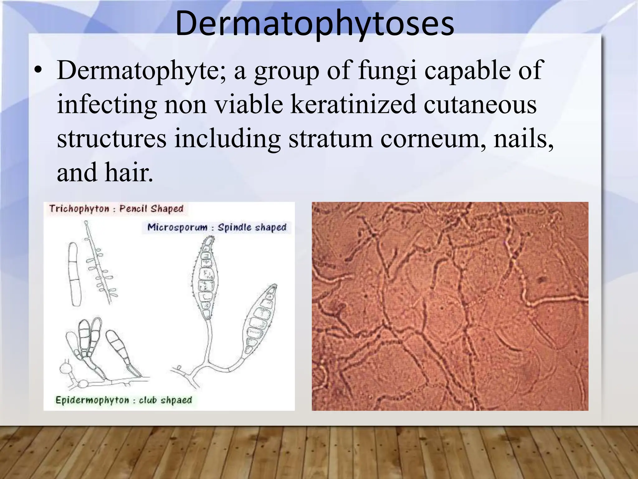 Common Fungal Infections of The Skin.ppt