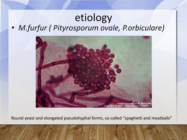 Common Fungal Infections of The Skin.ppt | Foot Health | Diseases and ...