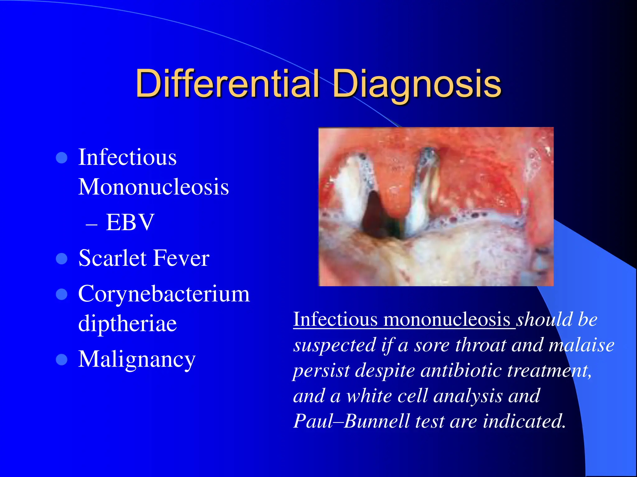 L6_TONSILLITIS.-ADENOIDS.-TONSILLAR-HYPERTROPHY-LECTURE.pdf