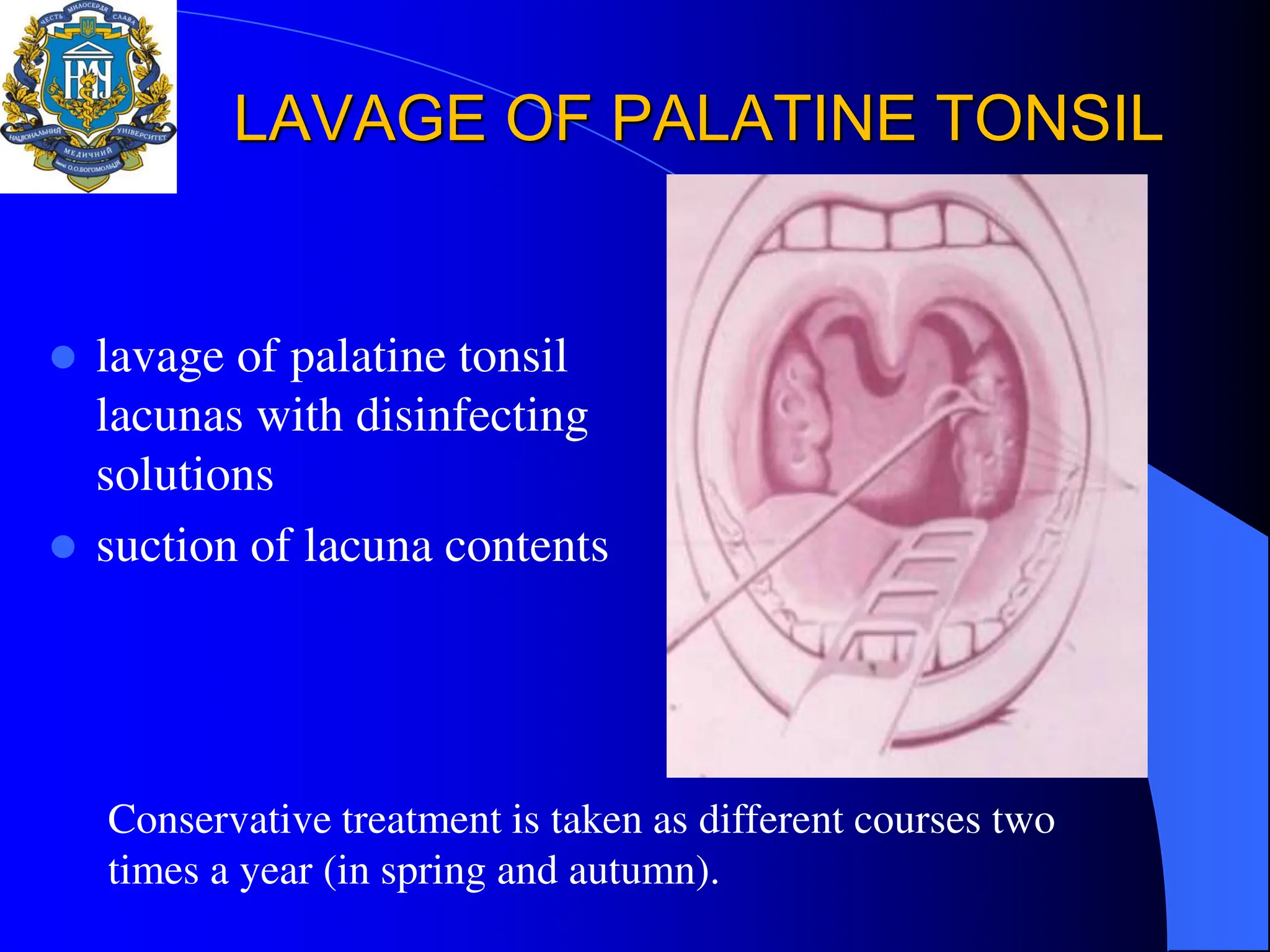 L6_TONSILLITIS.-ADENOIDS.-TONSILLAR-HYPERTROPHY-LECTURE.pdf