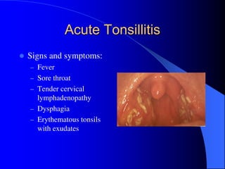 L6_TONSILLITIS.-ADENOIDS.-TONSILLAR-HYPERTROPHY-LECTURE.pdf