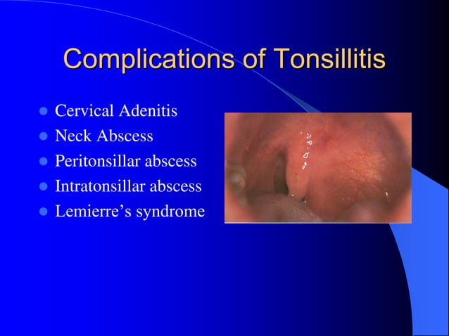 L6_TONSILLITIS.-ADENOIDS.-TONSILLAR-HYPERTROPHY-LECTURE.pdf