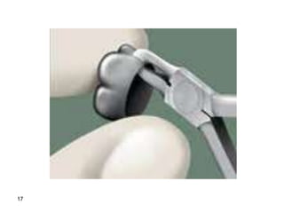 Pedodontic iii lecture 01 | PPT | Dental Health | Diseases and Conditions