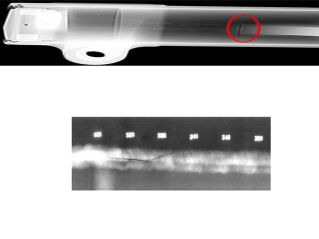 L7 overview of radiographic test | PPT