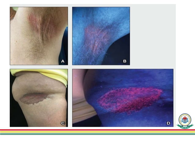 L8. Skin and soft tissue infections .pptx | Foot Health | Diseases and Conditions