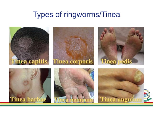 L8. Skin and soft tissue infections .pptx | Foot Health | Diseases and Conditions