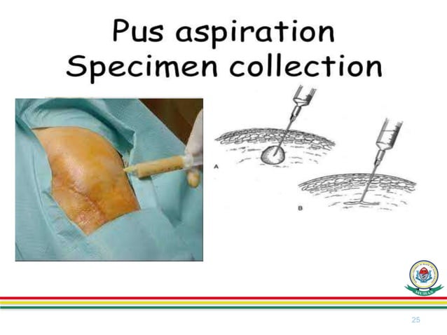 L8. Skin and soft tissue infections .pptx | Foot Health | Diseases and Conditions