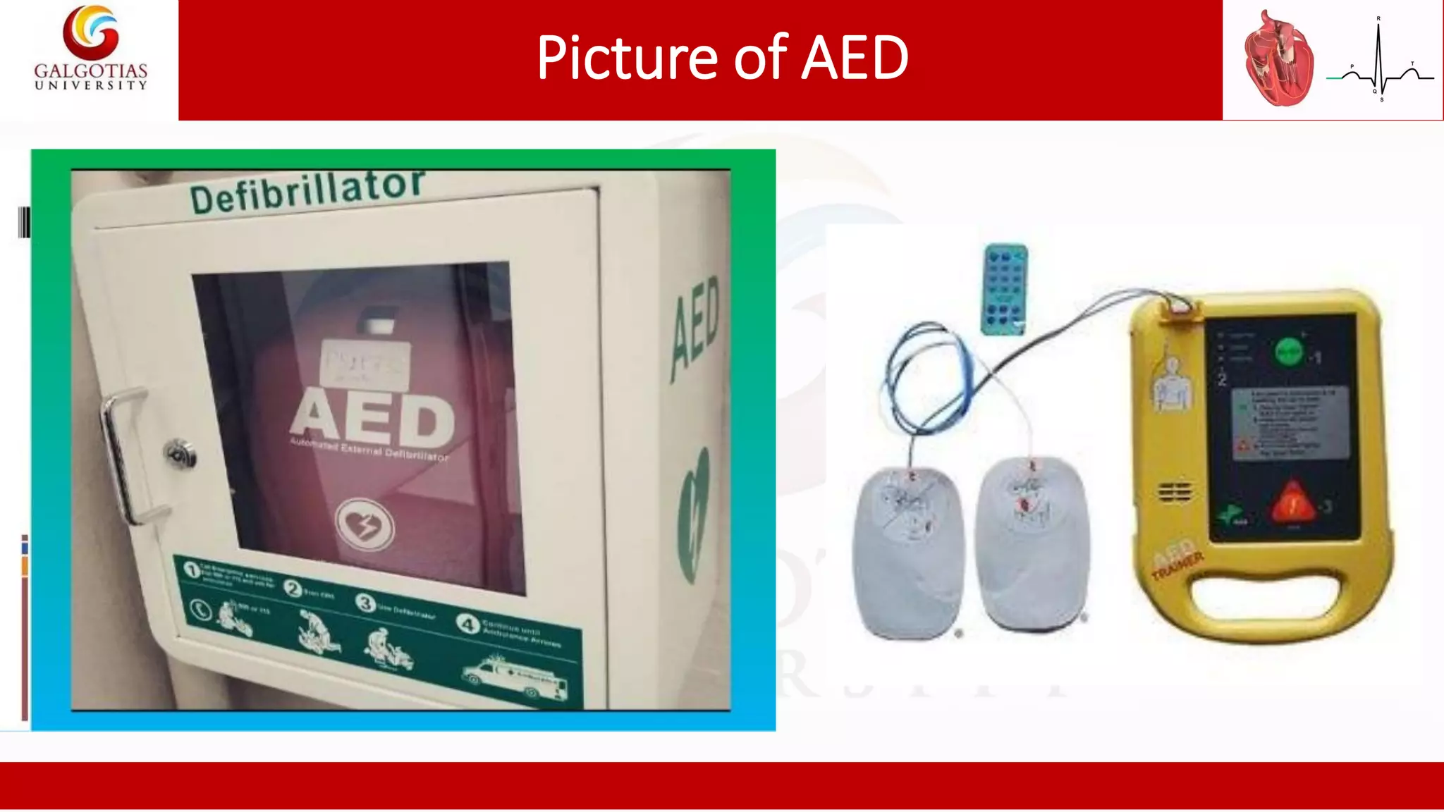 Automated External Defibrillator AED | PDF