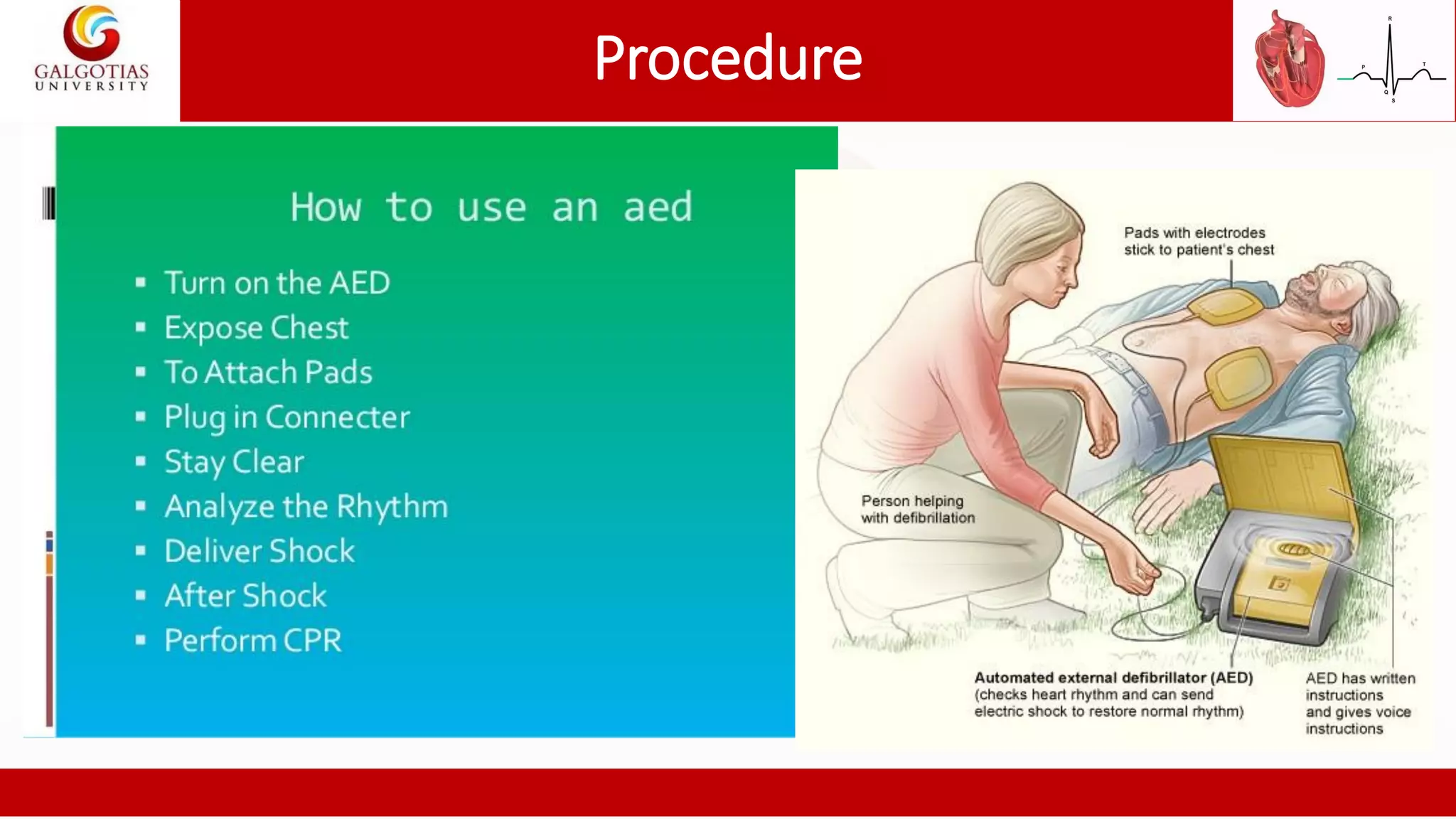 Automated External Defibrillator AED | PDF