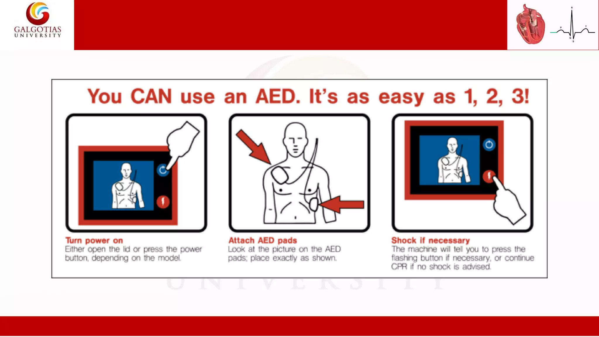 Automated External Defibrillator AED | PDF