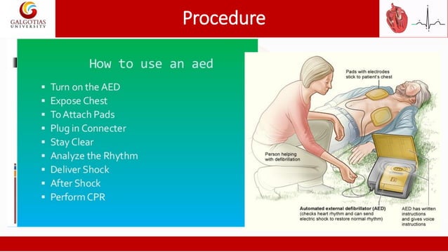 Automated External Defibrillator AED | PDF
