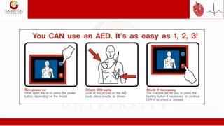 Automated External Defibrillator AED | PDF