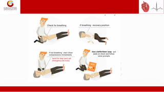 Automated External Defibrillator AED | PDF