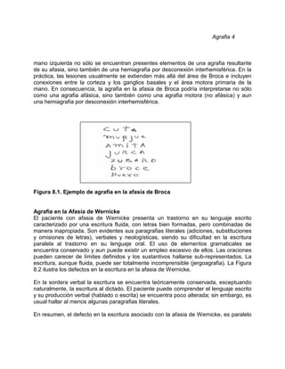 L8 Agrafia | PDF