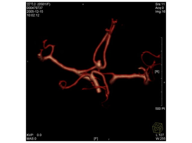 L8 circulation arteries | PPT