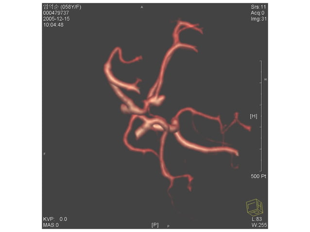 L8 circulation arteries | PPT