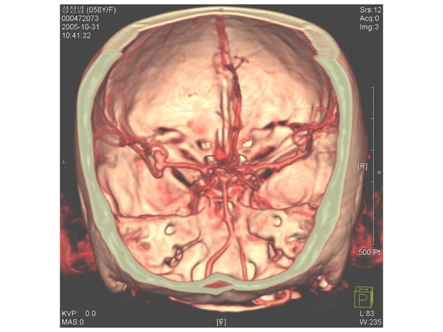 L8 circulation arteries | PPT | Free Download