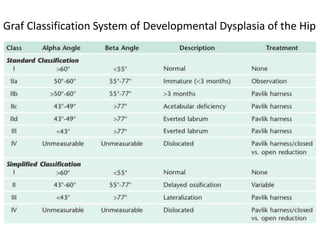 Developmental Dysplasia of Hip Radiological findings | PPTX
