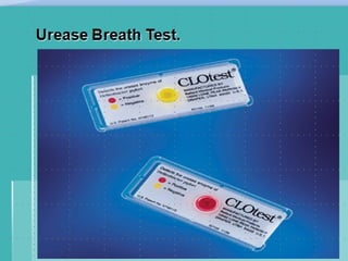 L8 peptic ulcer | PPT