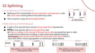 L9-Heart Sounds & Murmurs.pptxhshshshshsh | PPT