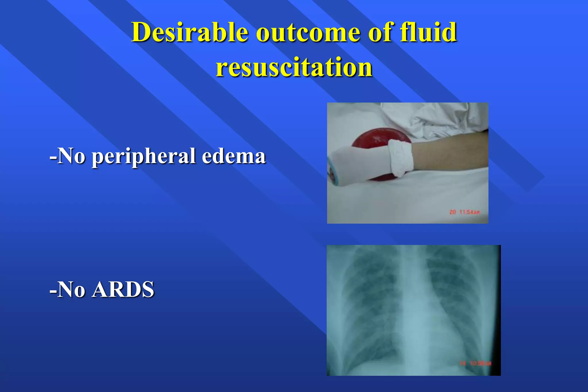 Intravenous fluid resuscitation and blood transfusion.ppt