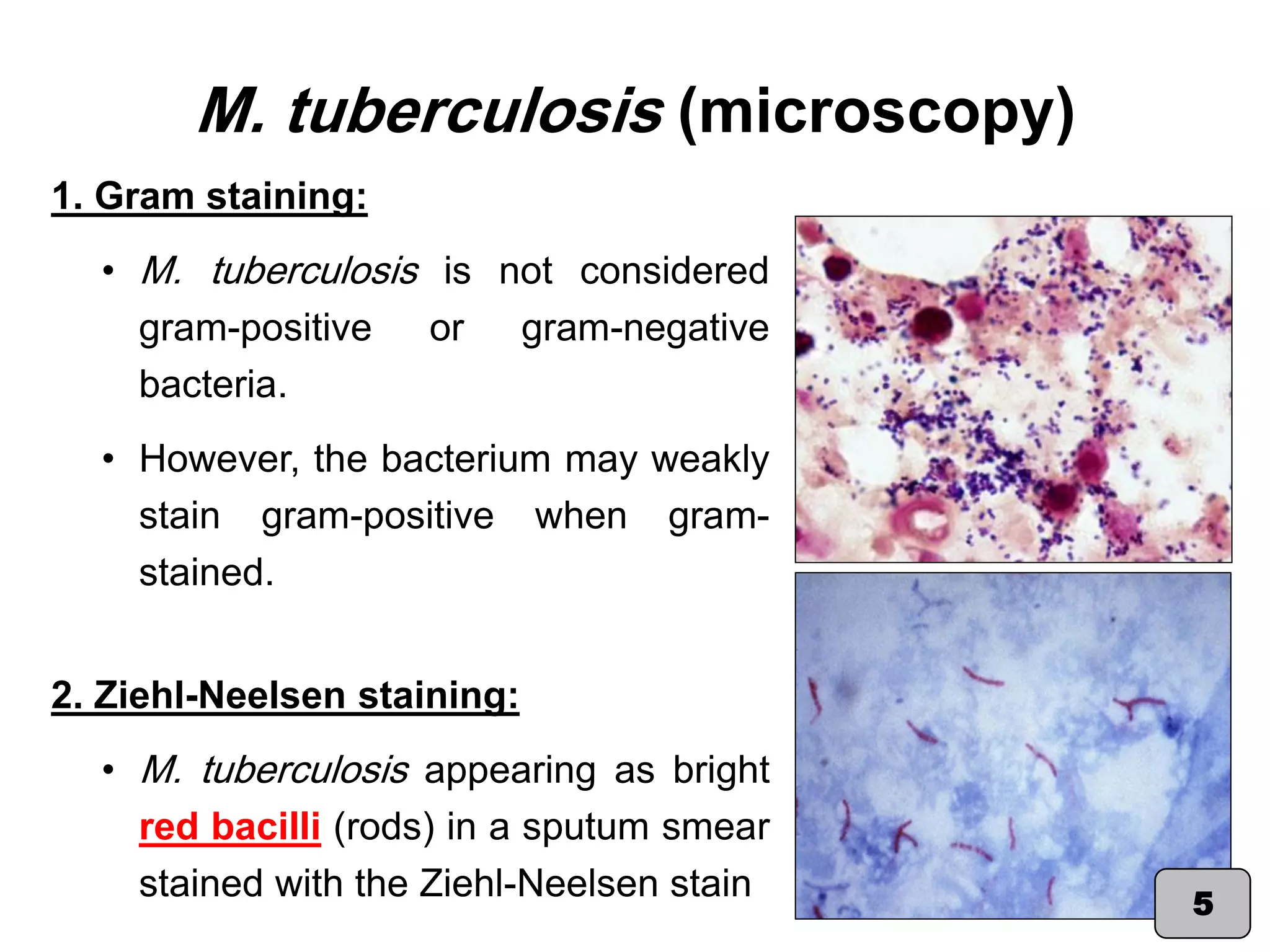 Mycobacterium tuberculosis (Practical Medical Microbiology, 14) | PDF
