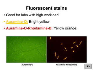 Mycobacterium tuberculosis (Practical Medical Microbiology, 14) | PPT