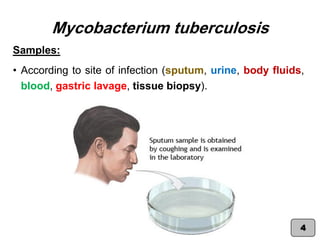 Mycobacterium tuberculosis (Practical Medical Microbiology, 14) | PPT
