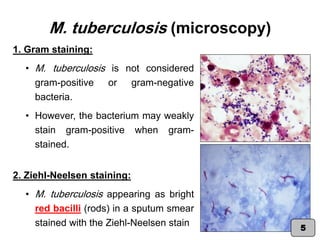 Mycobacterium Gram Stain