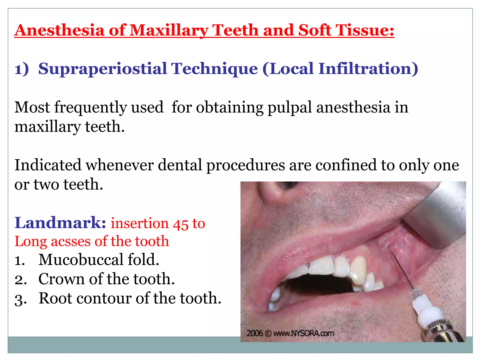 Local Anesthesia for pediatric dentistry | PPTX