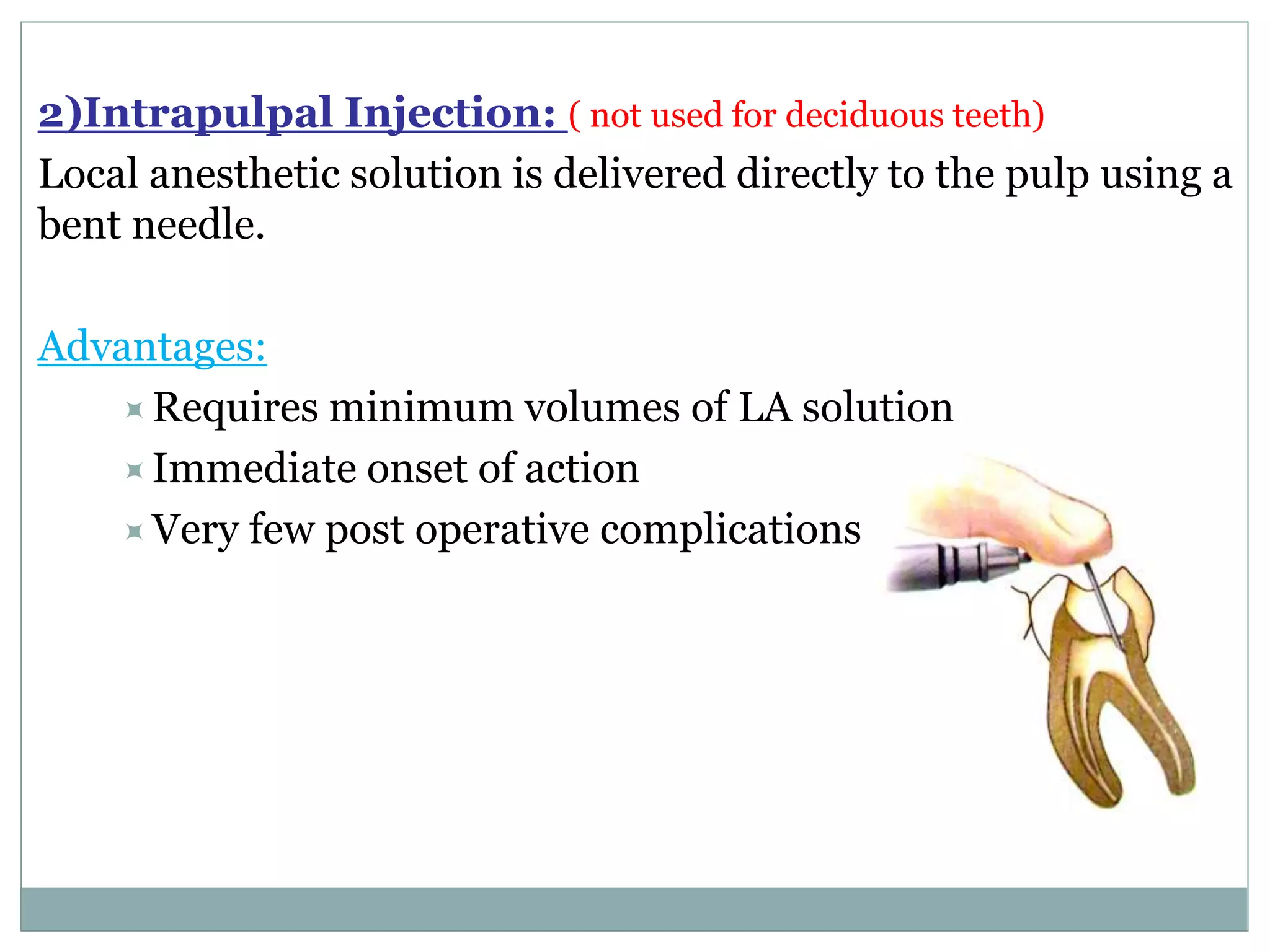 Local Anesthesia for pediatric dentistry | PPTX